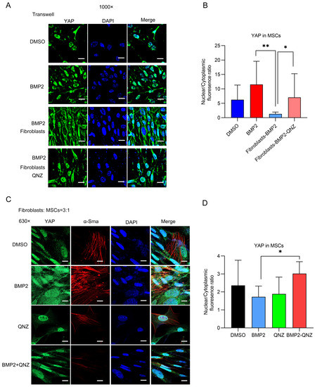 Synergistic Effect of QNZ, an Inhibitor of NF-κB Signaling, and Bone ...