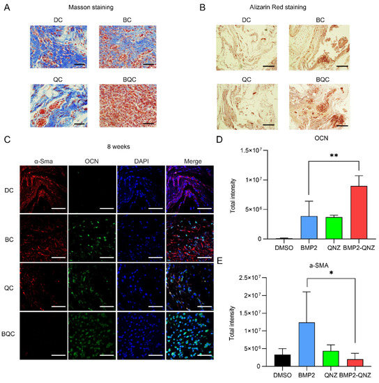 Synergistic Effect of QNZ, an Inhibitor of NF-κB Signaling, and Bone ...