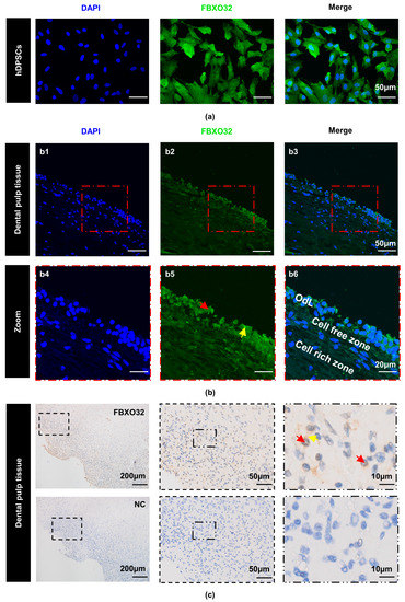 Promotive Effect of FBXO32 on the Odontoblastic Differentiation of ...