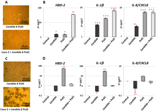 Immunomodulatory Effects of the Pea Defensin Psd1 in the Caco-2/Immune ...