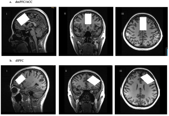 Evaluating Back-to-Back and Day-to-Day Reproducibility of Cortical ...
