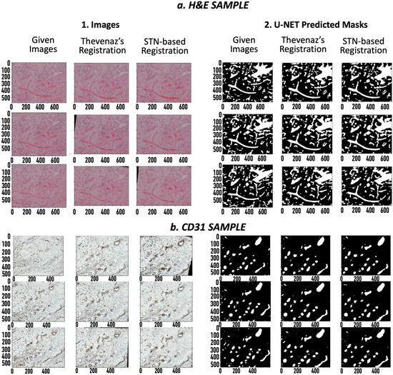 3D Visualization, Skeletonization and Branching Analysis of Blood ...