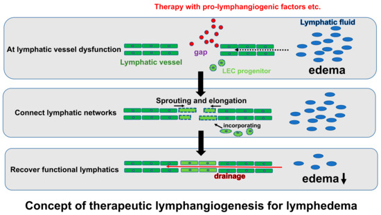 Therapeutic Lymphangiogenesis Is a Promising Strategy for Secondary ...