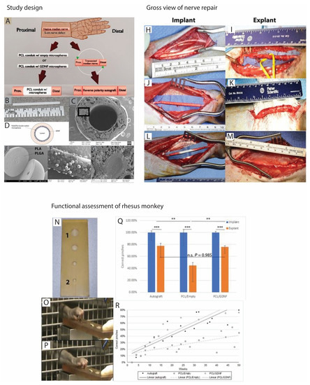 Mesenchymal Stem Cells in Nerve Tissue Engineering: Bridging Nerve Gap ...