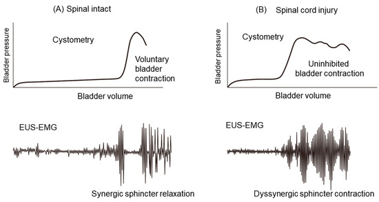Molecular Mechanisms of Neurogenic Lower Urinary Tract Dysfunction ...
