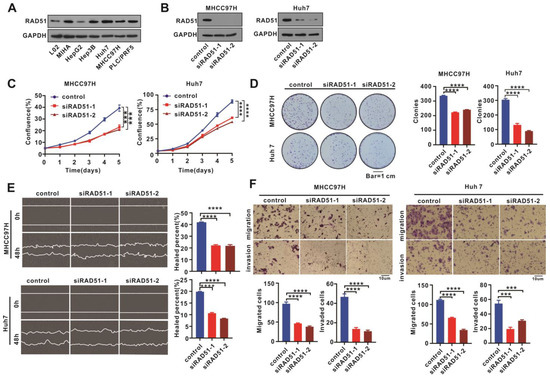 RAD51 Inhibition Shows Antitumor Activity in Hepatocellular Carcinoma