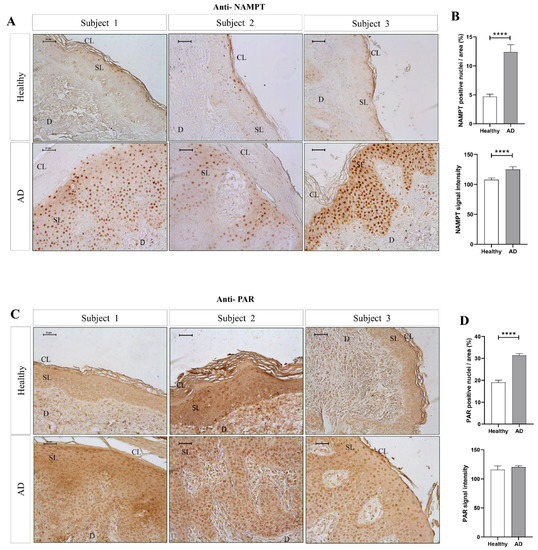 NAMPT and PARylation Are Involved in the Pathogenesis of Atopic Dermatitis