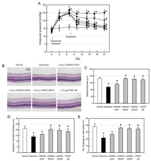Intraocular Pressure-Lowering and Retina-Protective Effects of Exosome ...