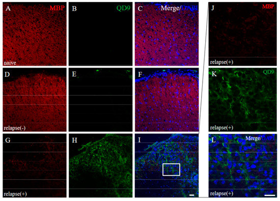 Involvement of Degenerating 21.5 kDa Isoform of Myelin Basic Protein in ...