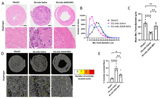 Microdystrophin Gene Addition Significantly Improves Muscle ...