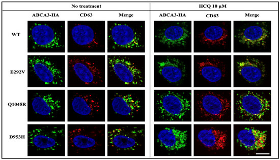 ABCA3 Deficiency—Variant-Specific Response to Hydroxychloroquine