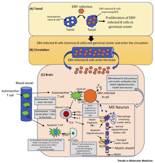 The State of the Art of Pediatric Multiple Sclerosis
