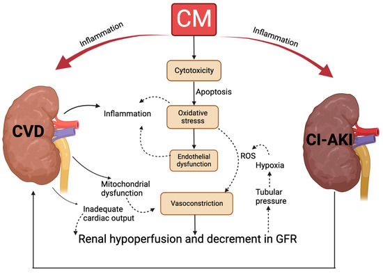 The Potential Biotherapeutic Targets of Contrast-Induced Acute Kidney ...