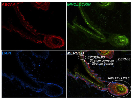 Role of the ABCA4 Gene Expression in the Clearance of Toxic Vitamin A ...