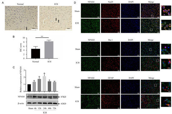 NPAS4 Exacerbates Pyroptosis via Transcriptionally Regulating NLRP6 in ...