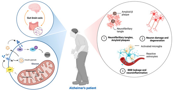 Systemic Metabolism and Mitochondria in the Mechanism of Alzheimer’s ...