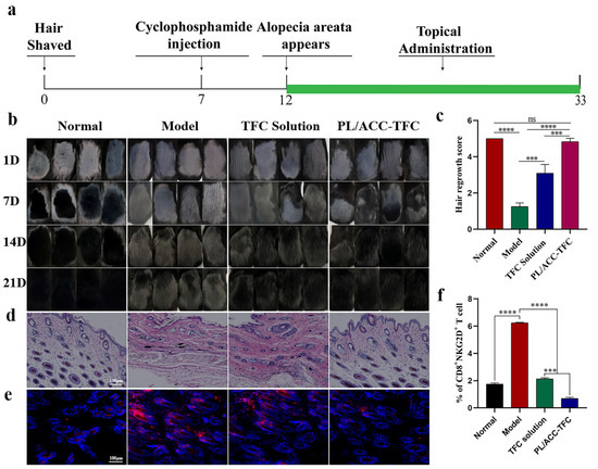 Selective Delivery of Tofacitinib Citrate to Hair Follicles Using Lipid ...