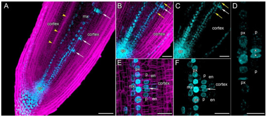 Lateral Root Initiation in Cucumber (Cucumis sativus): What Does the ...