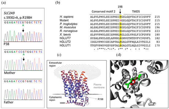 Pathogenic Variants of SLC22A12 (URAT1) and SLC2A9 (GLUT9) in Spanish ...