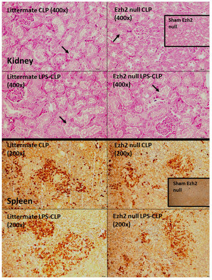 Less Severe Sepsis in Cecal Ligation and Puncture Models with and ...