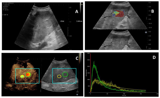 Ijms Free Full Text Multiparametric Dynamic Ultrasound Approach For