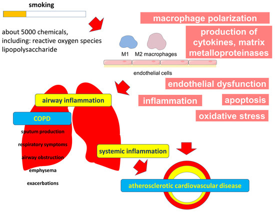 IJMS | Free Full-Text | The Role of Smoking in the Mechanisms of ...