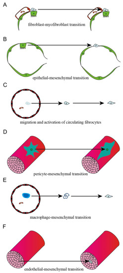 IJMS | Free Full-Text | Injured Endothelial Cell: A Risk Factor for Pulmonary Fibrosis