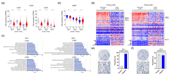 GNAQ-Regulated ZO-1 and ZO-2 Act as Tumor Suppressors by Modulating EMT ...