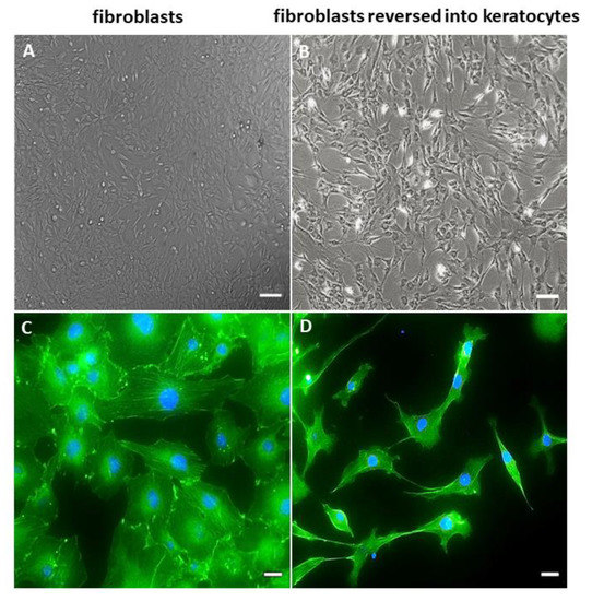 Derivation of Human Corneal Keratocytes from ReLEx SMILE Lenticules for ...