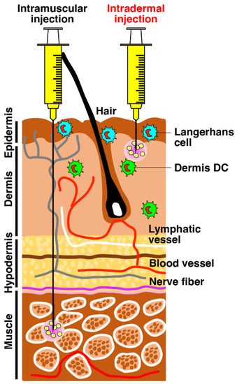 A Promising Needle-Free Pyro-Drive Jet Injector for Augmentation of ...
