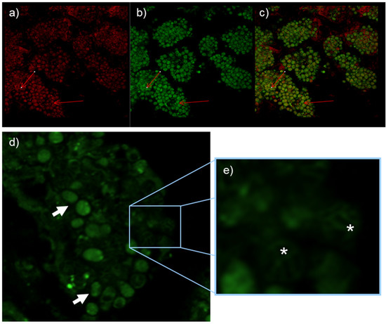 Frankia alni Carbonic Anhydrase Regulates Cytoplasmic pH of Nitrogen ...