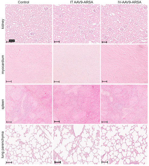 IJMS | Free Full-Text | Safety and Efficacy of Intravenous and ...