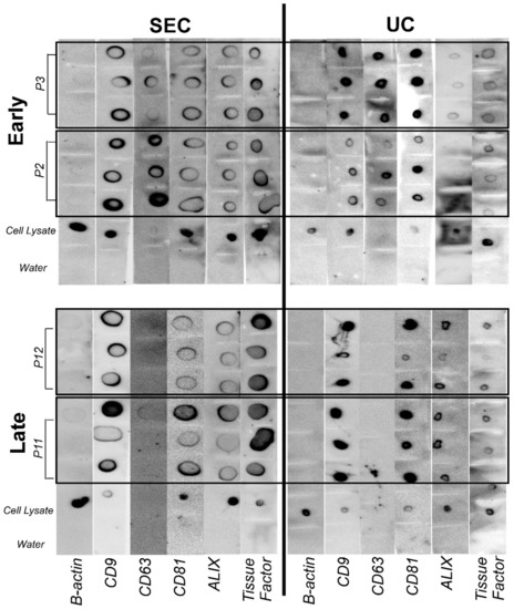 Procoagulant Activity of Umbilical Cord-Derived Mesenchymal Stromal ...