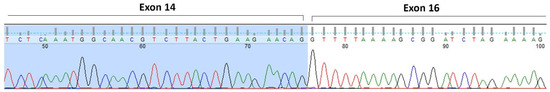 Alu-Mediated Insertions in the DMD Gene: A Difficult Puzzle to ...
