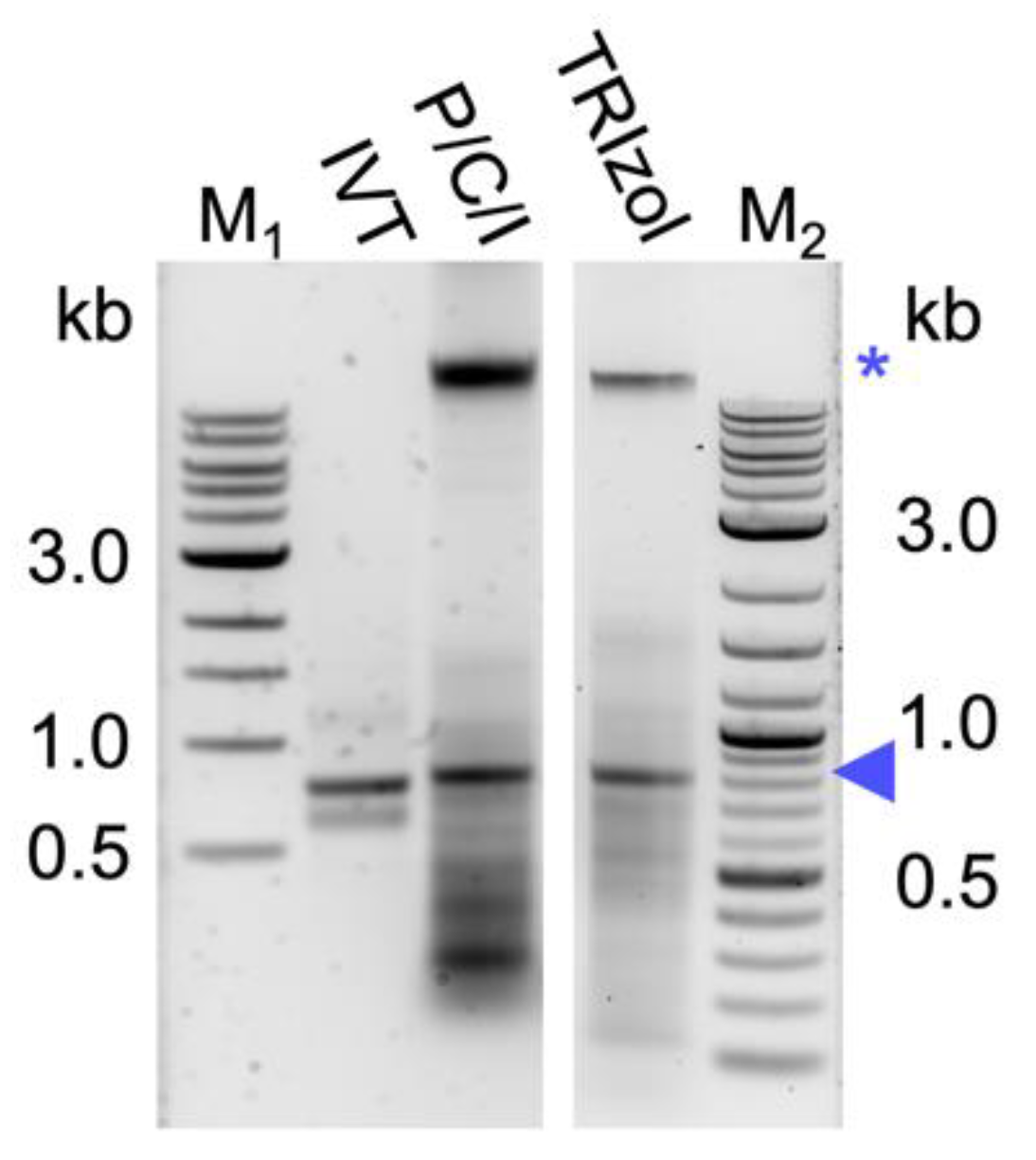 An Optimized/Scale Up-Ready Protocol for Extraction of Bacterially ...