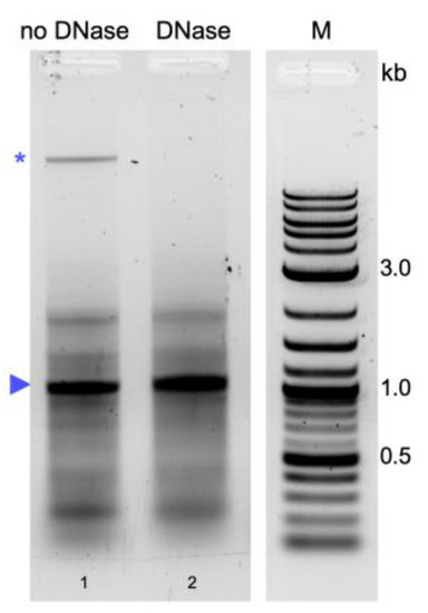 An Optimized/Scale Up-Ready Protocol for Extraction of Bacterially ...