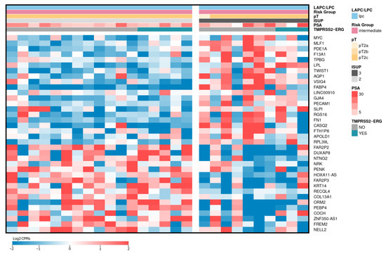 Transcriptome Profiling of Prostate Cancer, Considering Risk Groups and ...