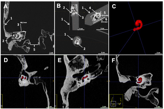 Immunohistochemistry Reveals TRPC Channels in the Human Hearing Organ—A ...