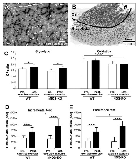 nNOS Increases Fiber Type-Specific Angiogenesis in Skeletal Muscle of ...