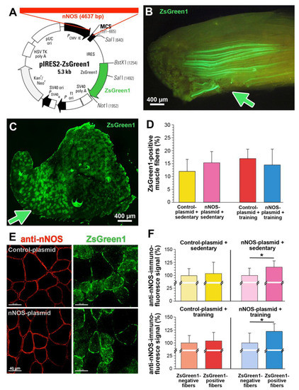 nNOS Increases Fiber Type-Specific Angiogenesis in Skeletal Muscle of ...