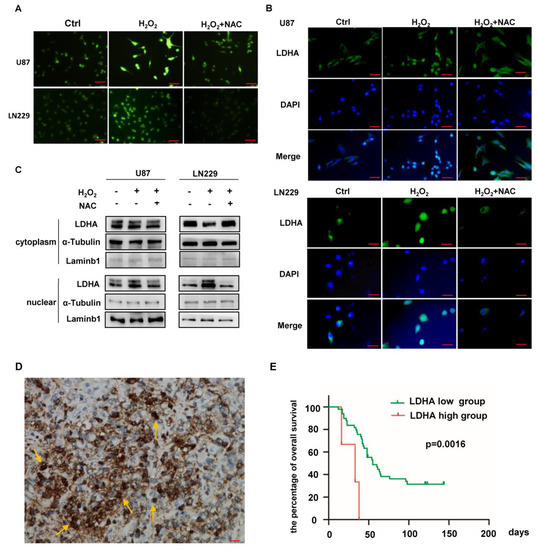 Nuclear Translocation of LDHA Promotes the Catabolism of BCAAs to ...