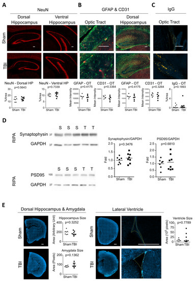 Altered Tau Kinase Activity in rTg4510 Mice after a Single Interfaced ...