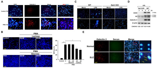 Galectin-3 Mediates NETosis and Acts as an Autoantigen in Systemic ...
