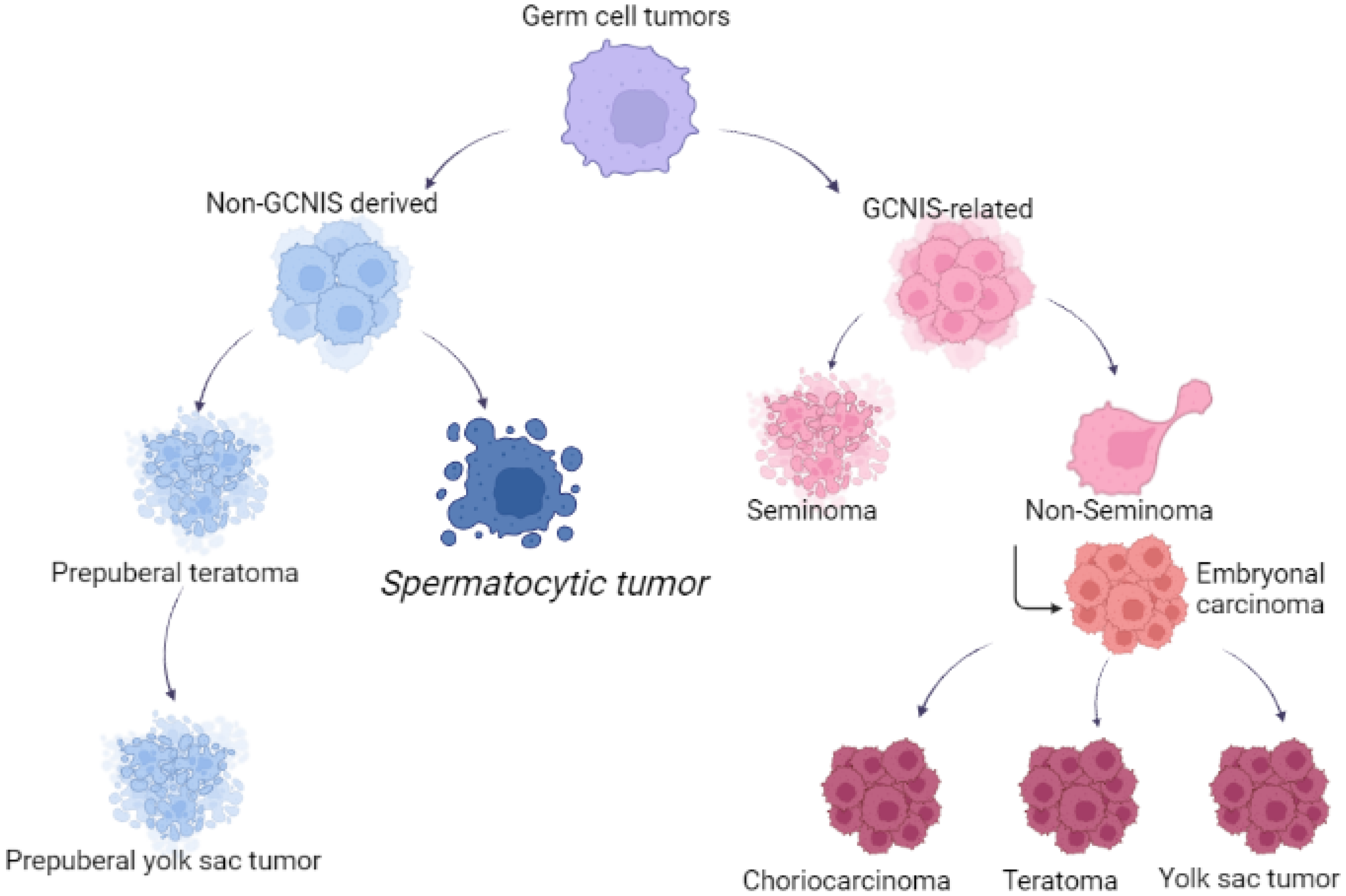 Yolk Sac Tumor Testicular Cancer Yolk Sac Tumor Testicular Cancer