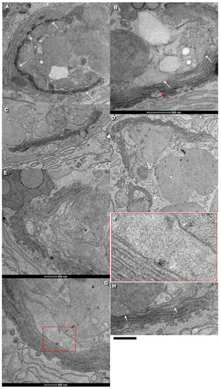 The Regulated Secretion and Models of Intracellular Transport: The ...