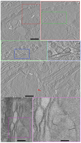 The Regulated Secretion and Models of Intracellular Transport: The ...
