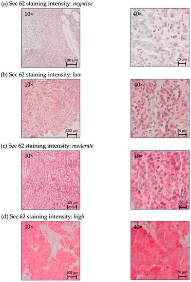 The 3q Oncogene SEC62 Predicts Response to Neoadjuvant Chemotherapy and ...