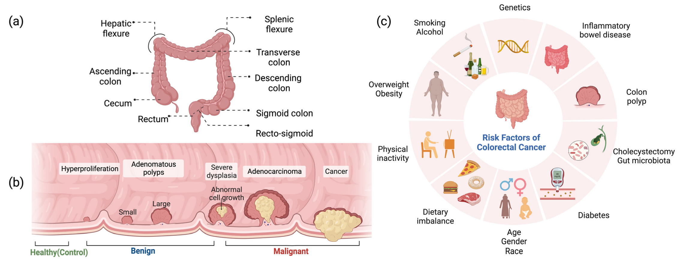 Ijms Free Full Text Comprehensive Insight Into Colorectal Cancer