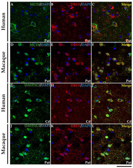 Thyroid Hormone Transporters MCT8 and OATP1C1 Are Expressed in ...