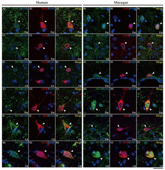 Thyroid Hormone Transporters MCT8 and OATP1C1 Are Expressed in ...
